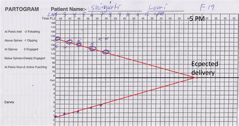 Image result for Partogram Design
