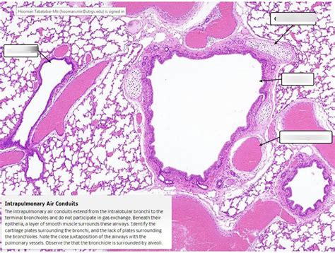 Image result for Intrapulmonary Air Space