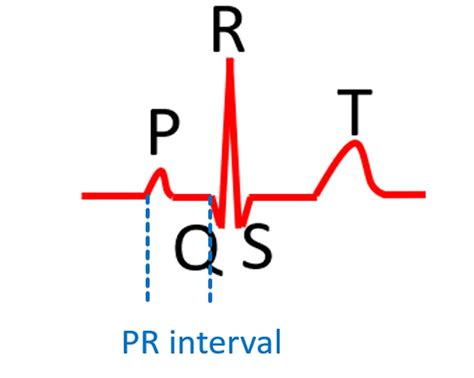 Image result for PR Interval ECG Boxes