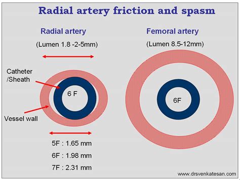 Image result for Angiogram Radial