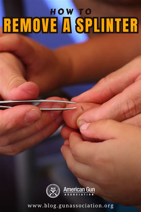 Image result for Splinter Remover