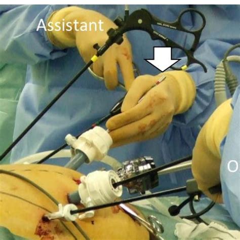 Image result for How to Build External TC