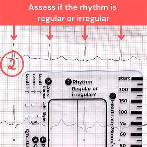 Image result for ECG Step by Step