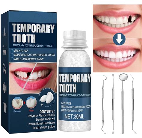 Image result for DIY Front Tooth Chip Repair Kit