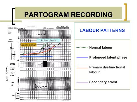 Image result for How to Fill the Partogram
