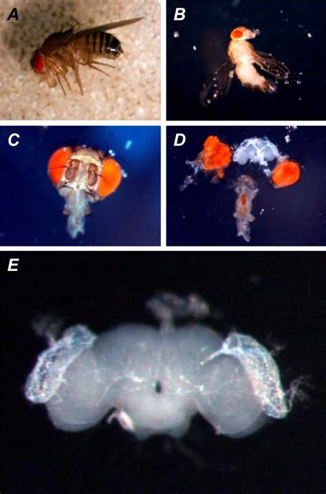 Image result for Brain Dissection