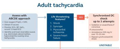Image result for Tachycardia Algorithm