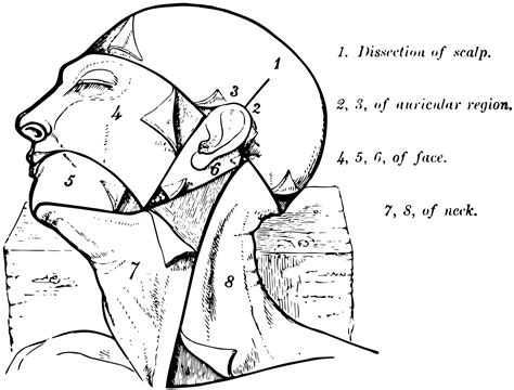 Image result for Dissection Cartoon