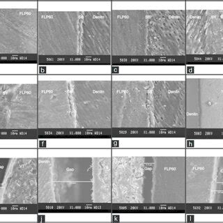 Image result for Scanning Electron Microscope Magnification