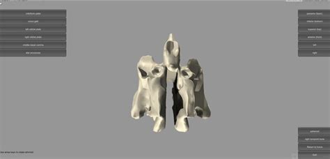 Image result for Bone Formation Learning