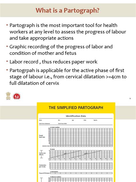 Image result for Types of Partograph