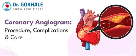 Coronary Angiogram: Procedure, Complications & Care