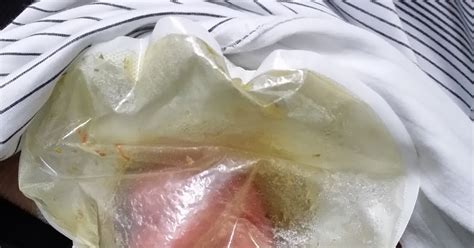 Image result for Colon Channel TCM