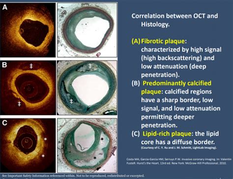 Image result for Oct Interpretation