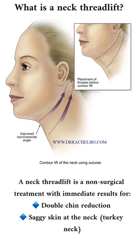 Image result for Back Neck Threading