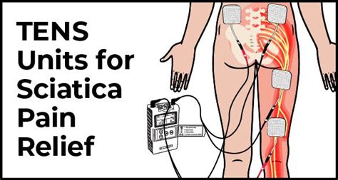 Image result for Tens Machine Sciatica