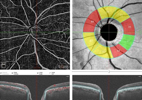 Image result for Oct Check