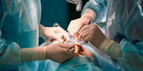 Image result for Trauma Surgery
