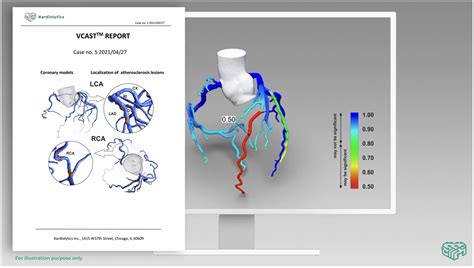 Image result for VCast Create System Test