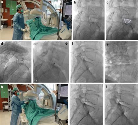 Image result for How to Pierce Injection