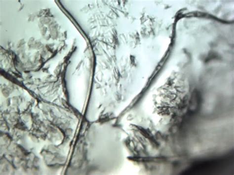 Image result for Pinworm Tape Test Procedure