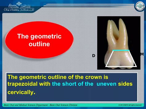 Image result for Maxillary First Molar