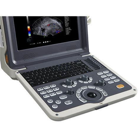 Image result for Color Doplor Machine