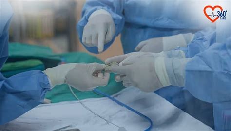 Image result for Different Types of Angiogram