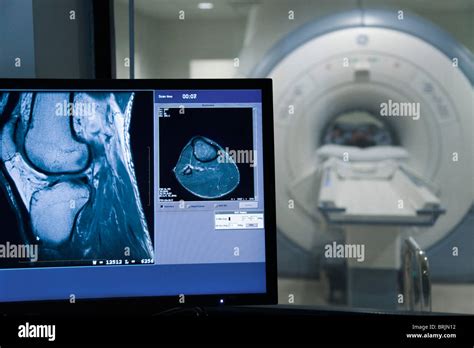 Image result for MicroScanner Result