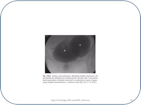 Image result for Voiding Cystourethrogram Background