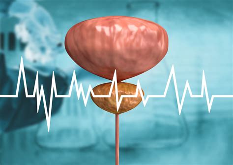 Image result for Simple Prostatectomy Surgery