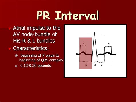 Image result for PR Interval ECG