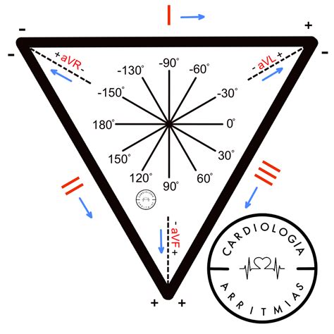 Image result for ECG 12 Derivaciones Normal