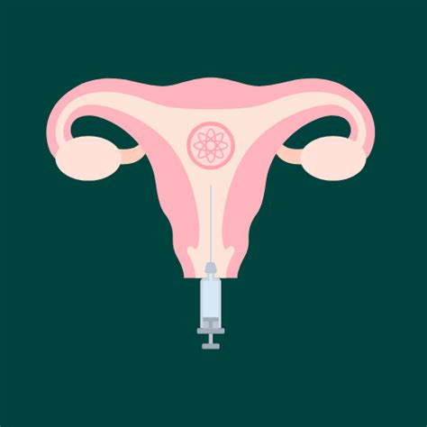 Image result for Watch Embryo Transfer