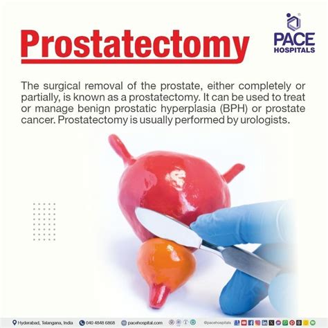 Image result for Prostatectomy Surgery Procedure