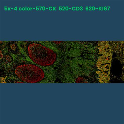 Image result for Multiplex IHC