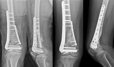 Image result for Trauma Surgery