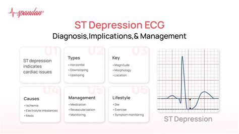 Image result for Types of ST Depression