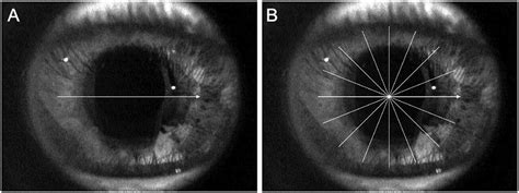 Image result for Oct Line Scan