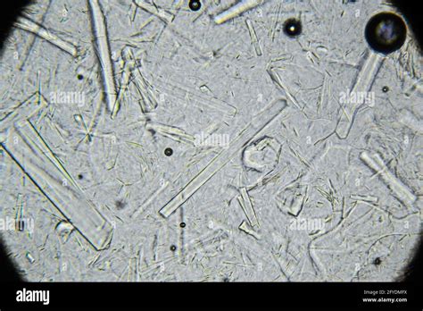 Image result for Crystal Structure Microscope