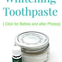 Make Your Own Tooth Whitening Paste with Before and After Photos at Mom ...