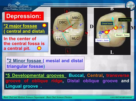 Image result for Maxillary First Molar