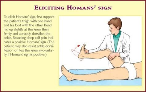 Image result for Positive Homans Sign