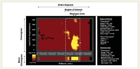 Image result for Near-Infrared Spectroscopy