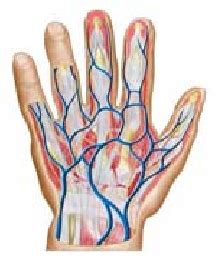 Image result for Hand Angiogram