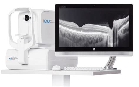 Image result for Normal OCT Scan