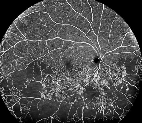 Image result for How Oct Works