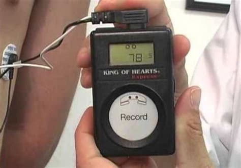 Image result for Loop Recorder ECG Test