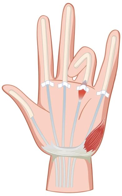 Image result for Hand Structure Drawing