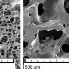Image result for Trabecular Bone Structure
